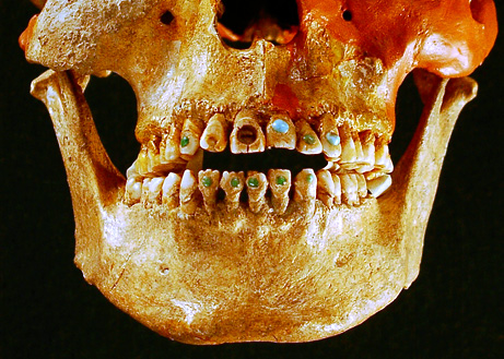 Ancient Dentistry Part 1: Drills, Gemstones and Toothpaste! | AntiquityNOW